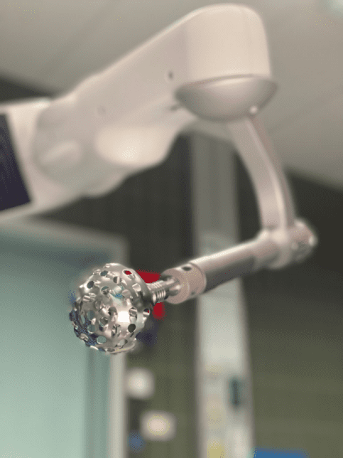 Totale heupprothese met robot - Orthopedie Lier : Orthopedie Lier